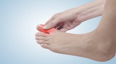 Comprehensive Turf Toe Treatment | Community Foot Clinic of McPherson