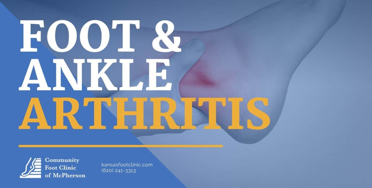 Excellent Foot Arthritis Treatment | Community Foot Clinic of McPherson