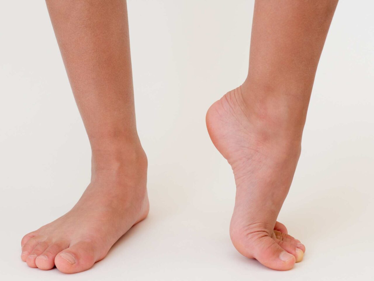 How Does Sever’s Disease Affect Children? - Community Foot Clinic of ...