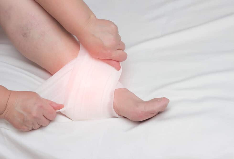 Heel Spurs in Athletes: Causes and Prevention - Community Foot Clinic ...